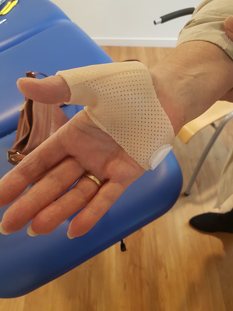 Spalktherapie bij hand-pols klachten - Fysio in Motion