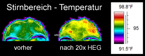 Was ist HEG Biofeedback? - Neurofeedback Lernberatung Frauenfeld
