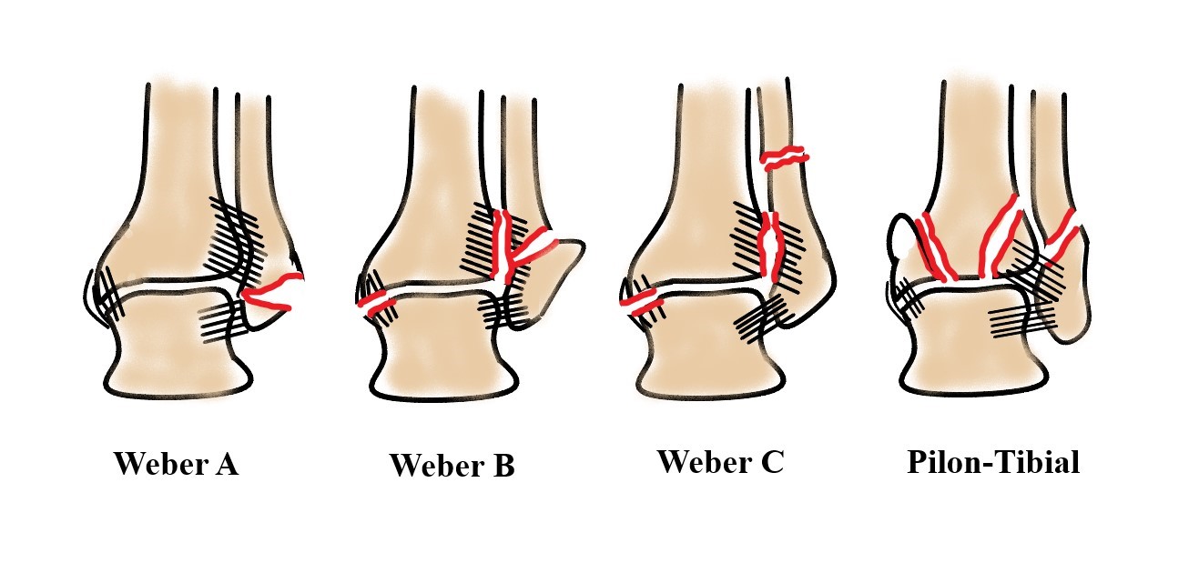 Region 3 OSG Spalt - see-feel-treats Webseite!