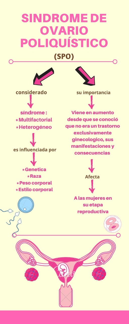 ¿Que es el síndrome de ovario poliquistico? - Página web de ...