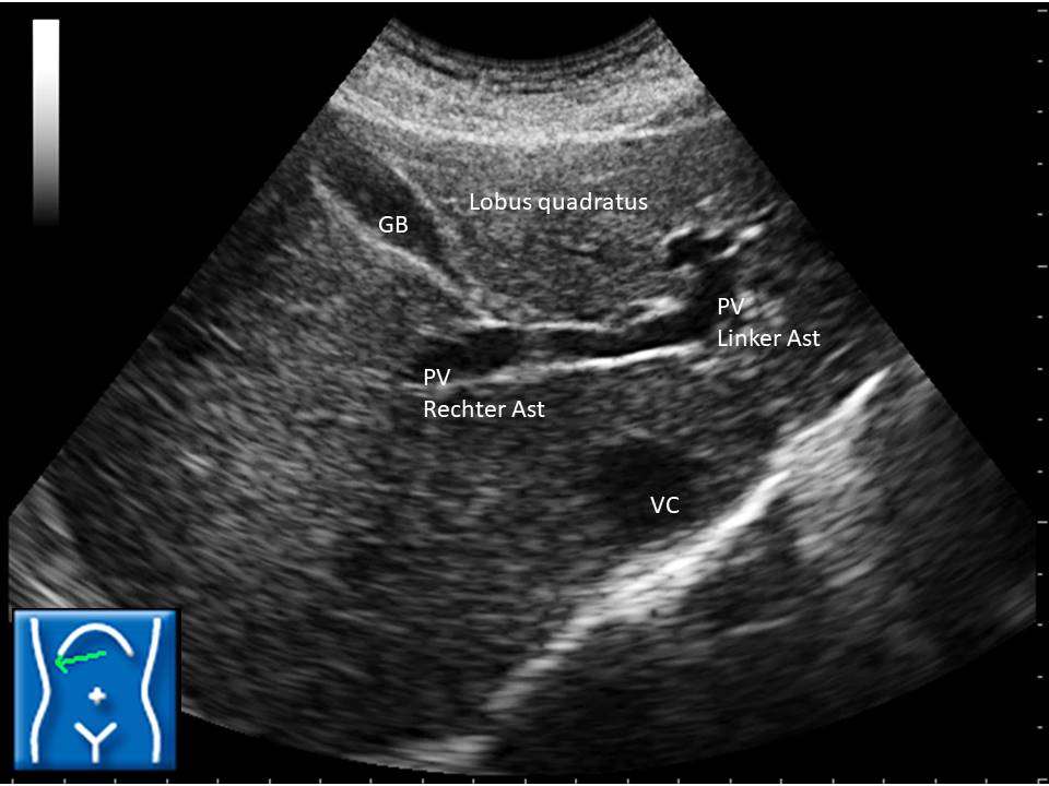 Die Sono-Anatomie der Leber - Praxis Dr. Faure in Krefeld