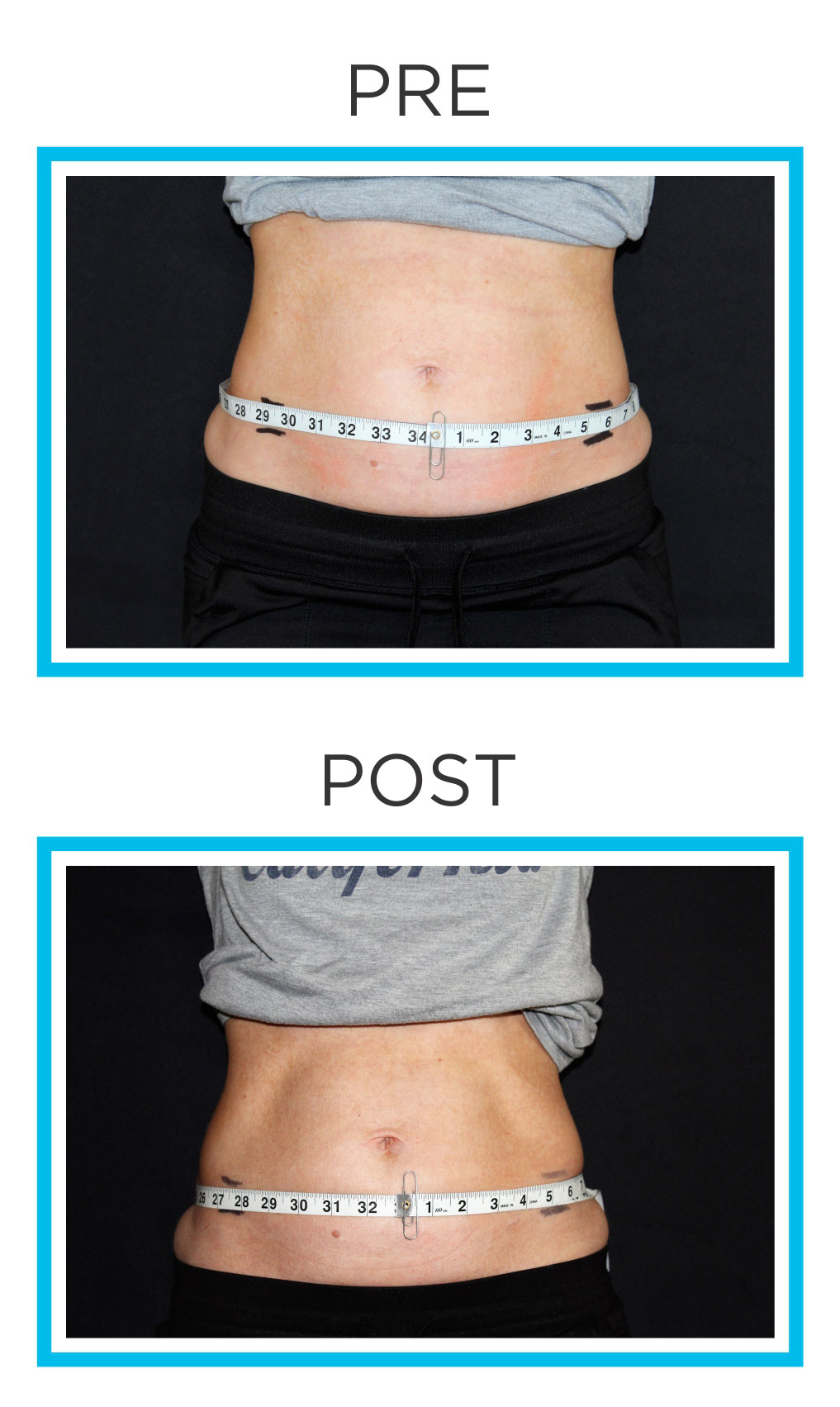 Photo Gallery - Ideal Curves