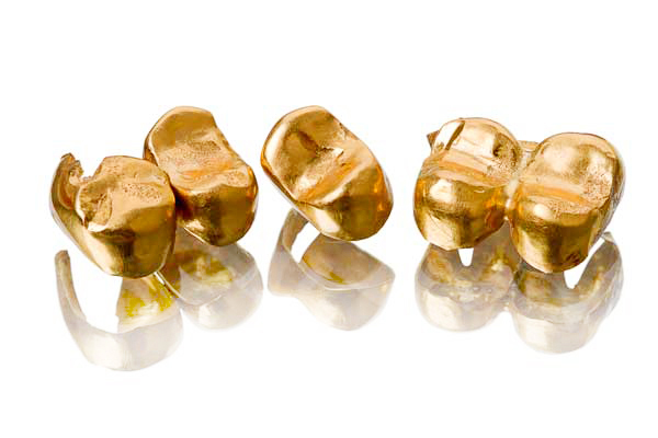 Ankauf von Zahngold in Hildesheim - Goldankauf Hildesheim