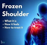 Frozen Shoulders - Completely Recoverable - bloodcirculationtherapy ページ！