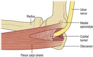 ulnar paradox reason